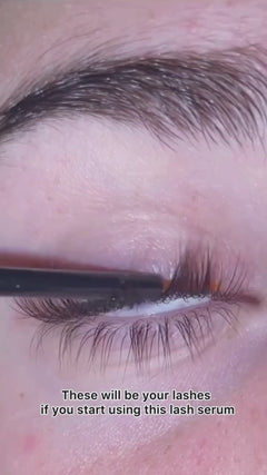 Lash & Brow Serum – Infinite Beautye